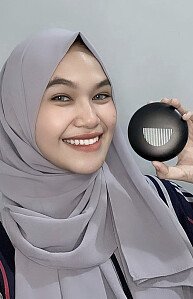 A Perfect Smile with KLAR Aligner | KLAR